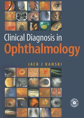Clinical Diagnosis in Ophthalmology by Jack J. Kanski | Goodreads