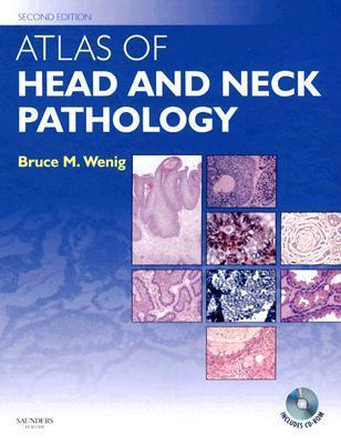 Atlas of Head and Neck Pathology with CD-ROM by Bruce M. Wenig MD ...