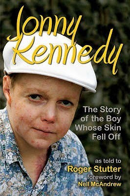 Jonny Kennedy: The Story of the Boy Whose Skin Fell Off by Stutter ...