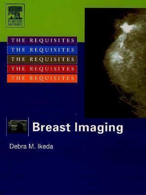 Breast Imaging: The Requisites (The Core Requisites) by Debra Ikeda ...