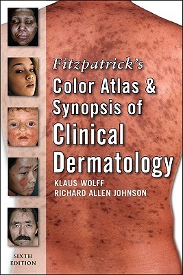 Fitzpatrick's Color Atlas and Synopsis of Clinical Dermatology by Klaus ...