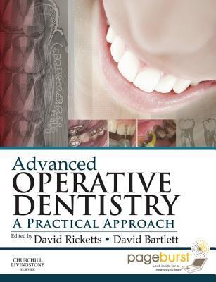 Advanced Operative Dentistry: A Practical Approach by David Ricketts ...