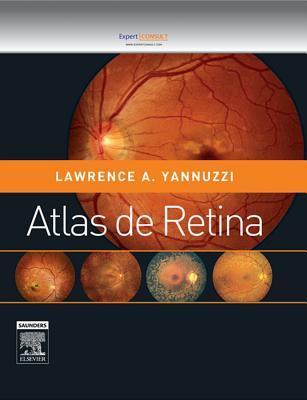 Atlas de Retina by Lawrence A. Yannuzzi | Goodreads