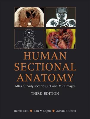 Human Sectional Anatomy: Atlas of Body Sections, CT and MRI Images by ...