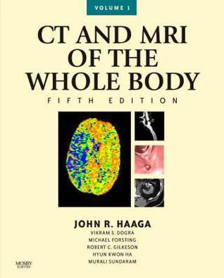 CT and MRI of the Whole Body by John R. Haaga MD FACR FSIR FSCBT FSRS ...