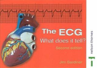 The ECG: What Does It Tell? by Jim Gardiner | Goodreads