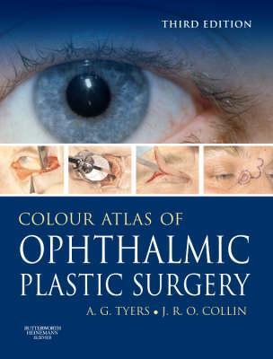 Colour Atlas of Ophthalmic Plastic Surgery with DVD by Anthony G. Tyers ...