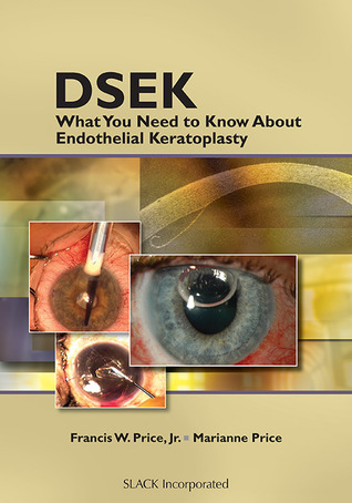 DSEK: What You Need to Know About Endothelial Keratoplasty by Frank W ...