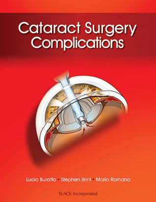 Cataract Surgery Complications by Lucio Buratto | Goodreads