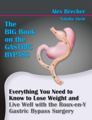 The BIG Book on the Gastric Bypass: Everything You Need To Know To Lose ...