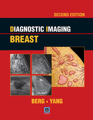 Diagnostic Imaging: Breast by Wendie A. Berg | Goodreads