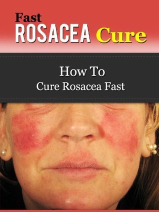 Fast Rosacea Cure - How To Cure Rosacea Fast by Ben Taylor | Goodreads