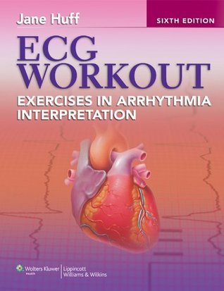 ECG Workout: Exercises in Arrhythmia Interpretation by Jane Huff ...