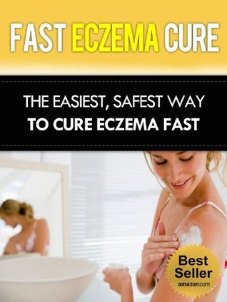Eczema Cure - The Easiest, Safest Way To Cure Eczema Fast by Mike ...