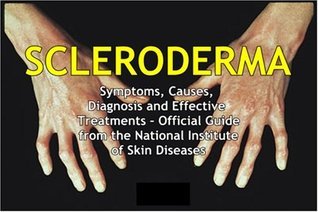 SCLERODERMA: Symptoms, Causes, Diagnosis and Effective Treatments ...