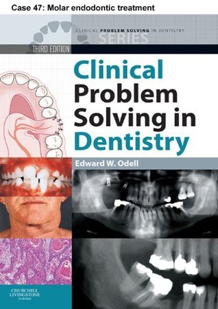 Clinical Problem Solving in Dentistry: Case 47: Molar Endodontic Treatment by Edward W. Odell ...