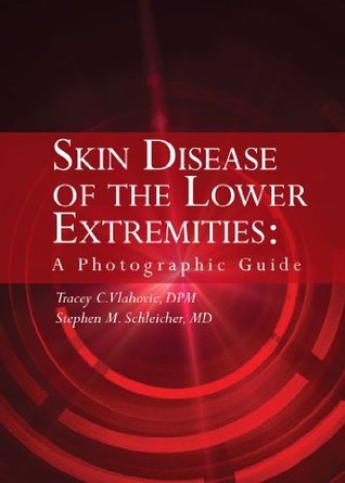 Skin Disease of the Lower Extremities: A Photographic Guide by Stephen ...