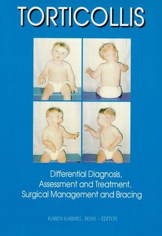 Torticollis : Differential Diagnosis, Assessment, and Treatment ...