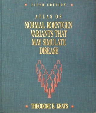 Atlas of Normal Roentgen Variants That May Simulate Disease by Theodore ...