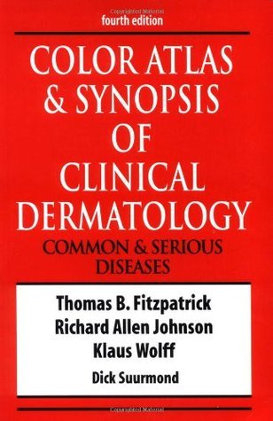 Color Atlas & Synopsis of Clinical Dermatology by Thomas Bernard Fitzpatrick | Goodreads