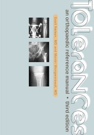 Tolerances: An Orthopaedic Reference Manual by Scott C. Nelson | Goodreads