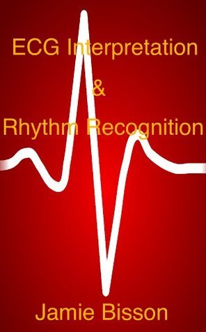 ECG Interpretation & Rhythm Recognition by Jamie Bisson | Goodreads