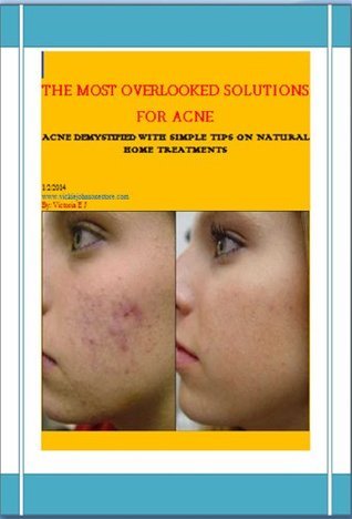 TWO WEEKS ACNE SOLUTION: THE BEST ACNE TREATMENT by Victoria Johnson ...