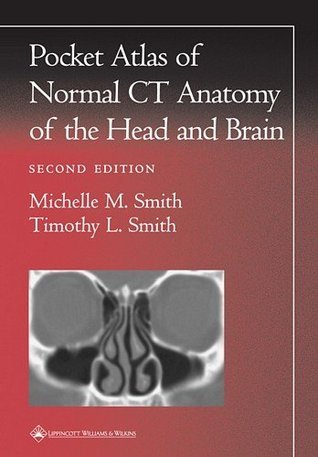Pocket Atlas of Normal CT Anatomy of the Head and Brain by Michelle M ...