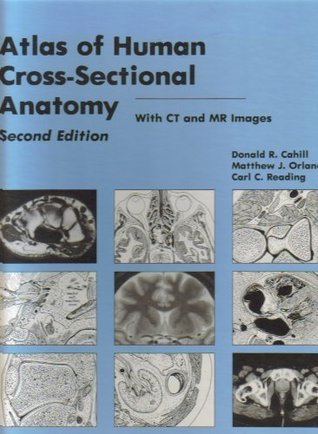 Atlas of Human Cross-Sectional Anatomy by Donald R. Cahill | Goodreads