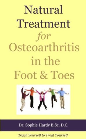 Natural Treatment for Osteoarthritis in the Foot and Toes by Sophie ...