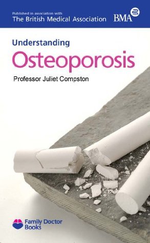 Understanding Osteoporosis (Family Doctor Books) by Juliet Compston ...