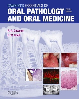 Cawson's Essentials of Oral Pathology and Oral Medicine E-Book by ...