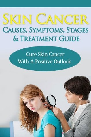 Skin Cancer Causes, Symptoms, Stages & Treatment Guide: Cure Skin ...