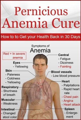 Anemia Eyes Symptoms