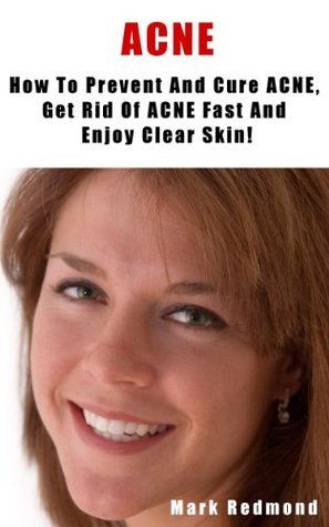 ACNE: How To Prevent And Cure ACNE, Get Rid Of ACNE Fast And Enjoy ...