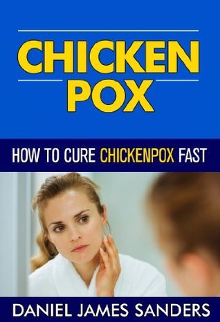 Chicken Pox: How To Cure Chickenpox Fast Naturally by Daniel James ...