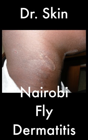 Nairobi Fly Dermatitis by Dr. Skin | Goodreads