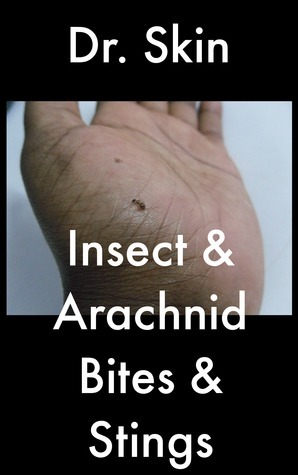 Insect and Arachnid Bites and Stings by Dr. Skin | Goodreads