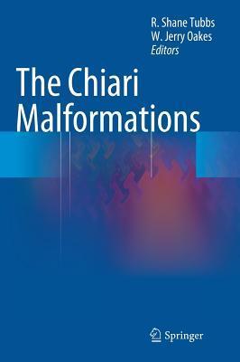 The Chiari Malformations by R. Shane Tubbs | Goodreads