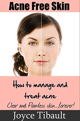 Your Best Guide to Acne-Free Skin: How to Manage and Treat Acne for a ...