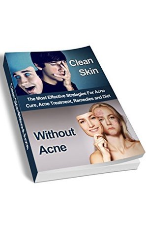 Acne Cure: The Most Effective Strategies To Get Rid Of Acne, Treatment ...