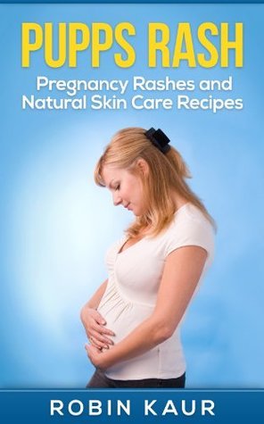 Pupps Rash: Pregnancy Rashes and Natural Skin Care Recipes by Robin ...