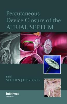 Percutaneous Device Closure of the Atrial Septum by Stephen Brecker ...