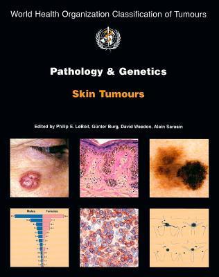 Pathology and Genetics of Tumours of the Skin. Who Classification of ...