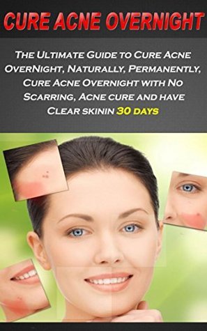 Acne: The Ultimate Guide to Cure Acne OverNight, Naturally, Permanently ...