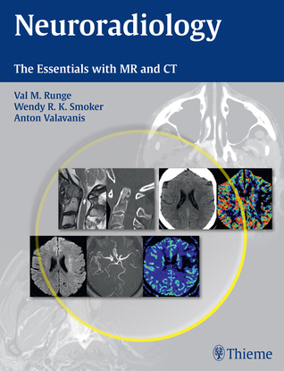 Neuroradiology: The Essentials with MR and CT by Val M. Runge | Goodreads