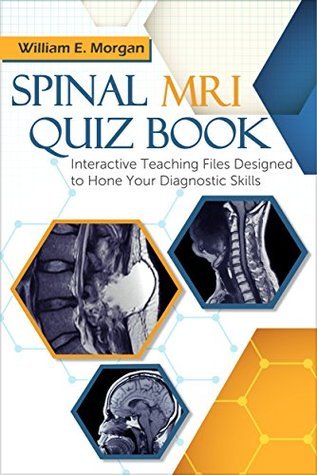 Spinal MRI Quiz Book: Interactive Teaching Files Designed to Hone Your ...