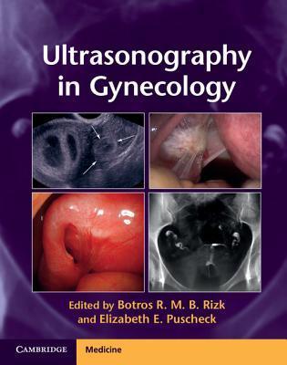 Ultrasonography in Gynecology by Botros R.M.B Rizk | Goodreads