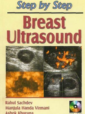 Step by Step Breast Ultrasound by Rahul Sachdev | Goodreads