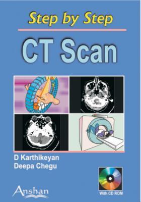 Step by Step Ct Scan: A Practical Guide for Residents and Technologists ...